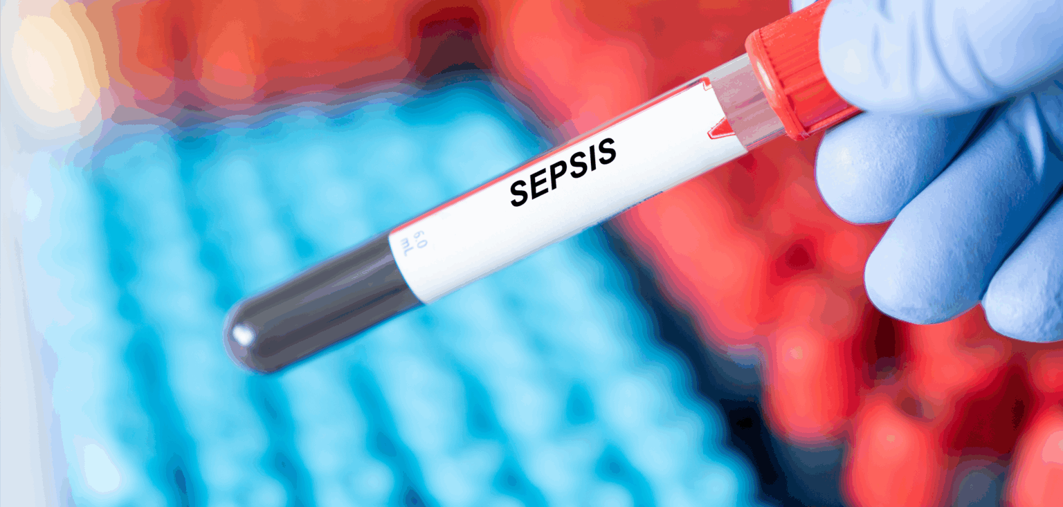 Medical Malpractice & Sepsis: Signs, Prevention & Legal Help